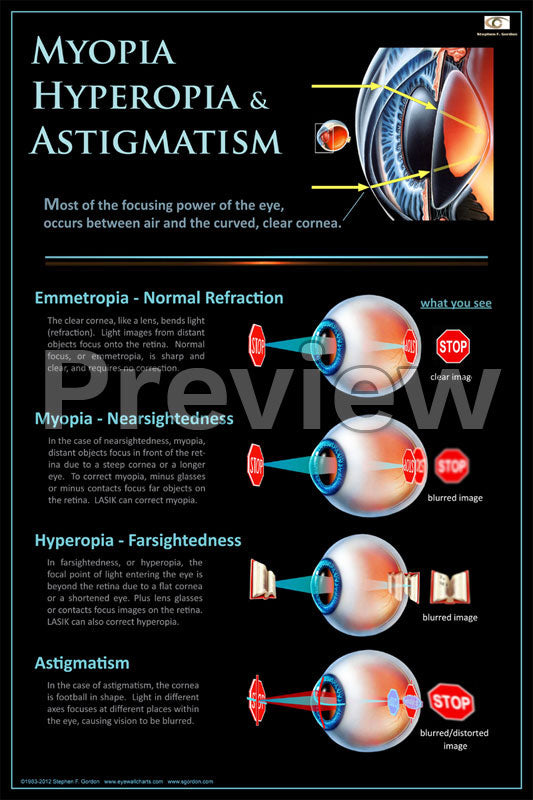 Myopia Hyperopia Astigmatism
