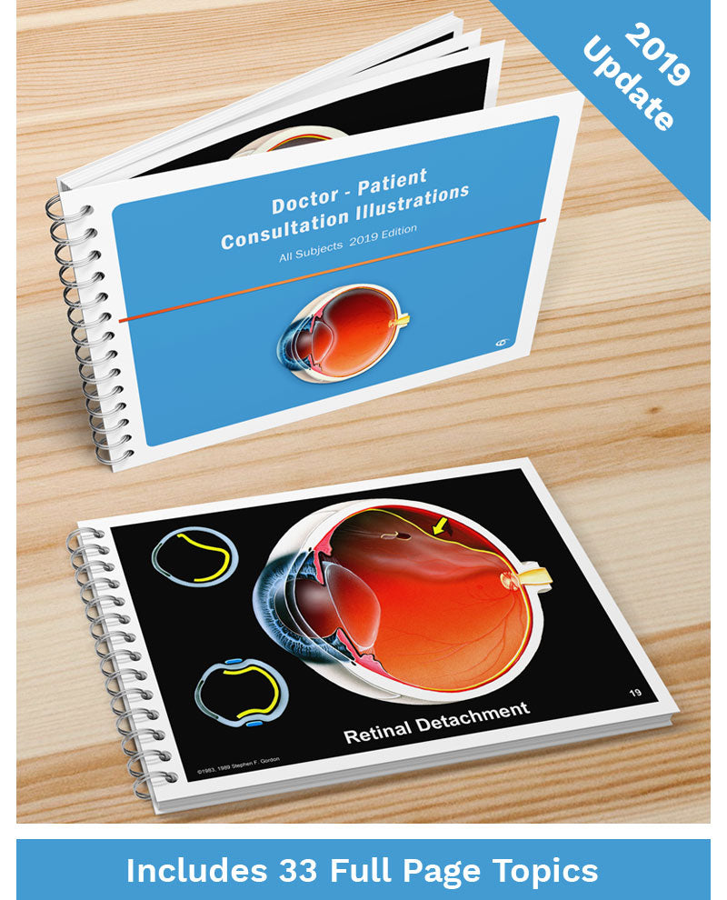Doctor-Patient Consultation Illustrations – Eye Flip Charts by Stephen ...