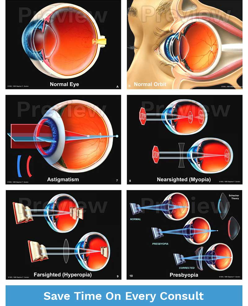 Doctor-Patient Consultation Illustrations – Eye Flip Charts by Stephen ...