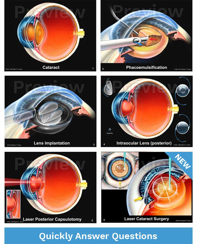 Doctor-Patient Consultation Illustrations – Eye Flip Charts by Stephen ...